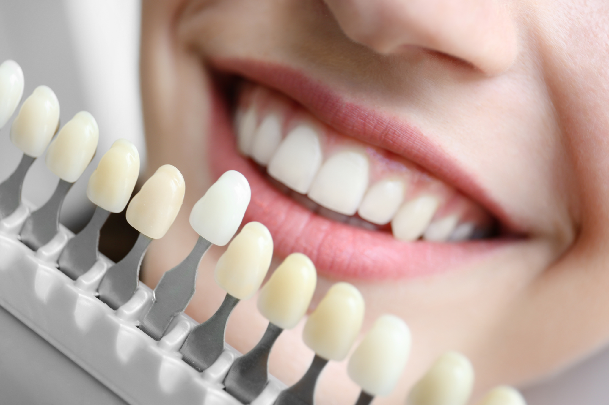 Cosmetic Dentistry Services - Zeik Dental